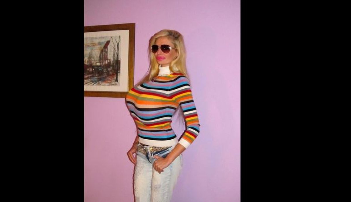 Victoria Wild gastó más de 40 mil dólares en cirugías para verse como ...